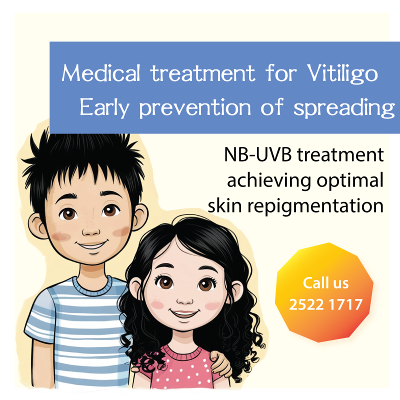 NB-UVB Treatment for Vitiligo - Early prevention of spreading